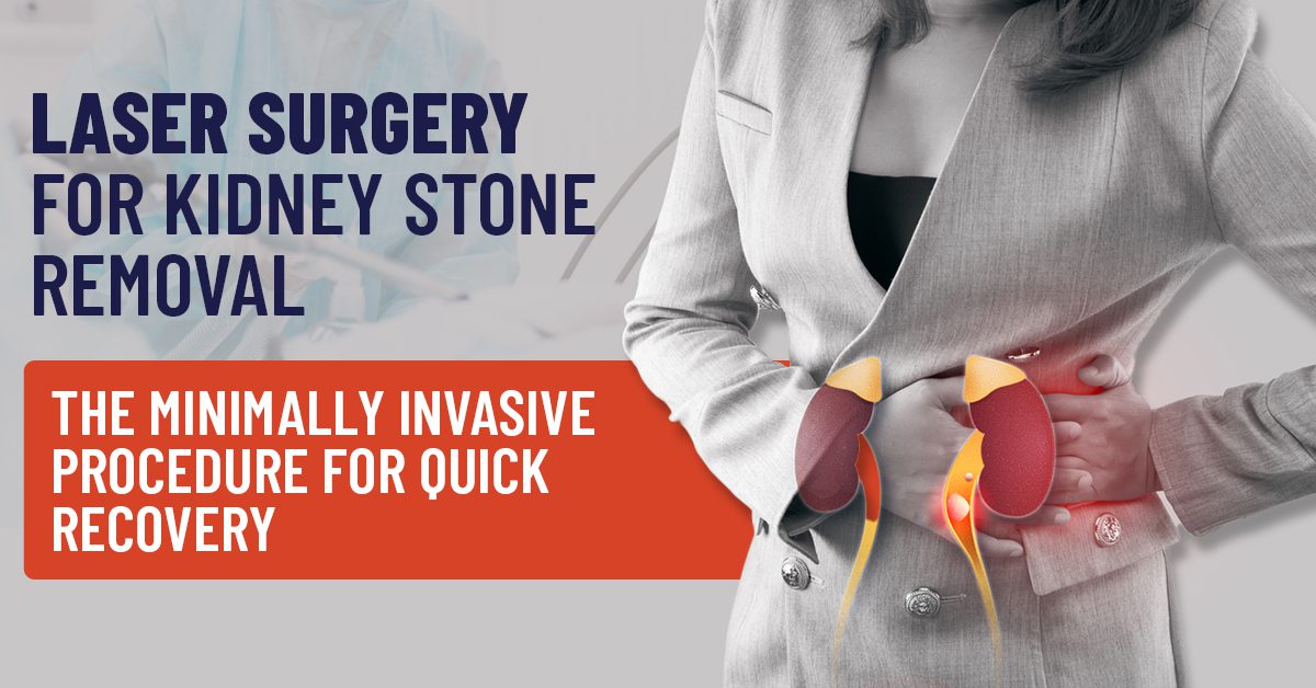 Advanced Laser Surgery for Kidney Stone Removal in Vadodara